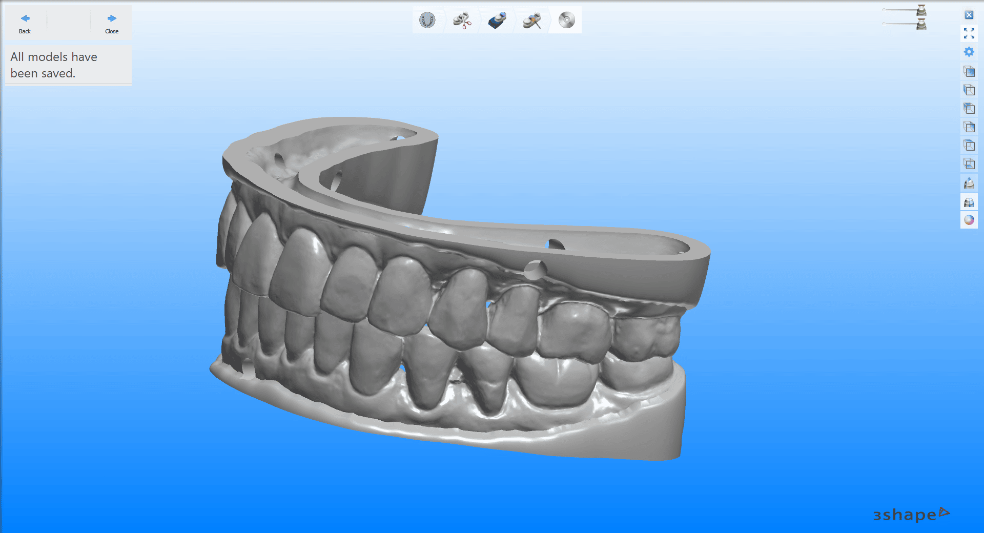 FLEXIBLE PARTIAL DENTURES - Utica Dental Laboratory