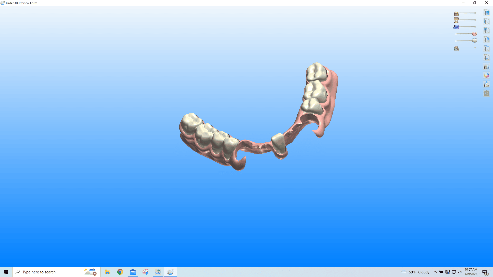 FLEXIBLE PARTIAL DENTURES - Utica Dental Laboratory