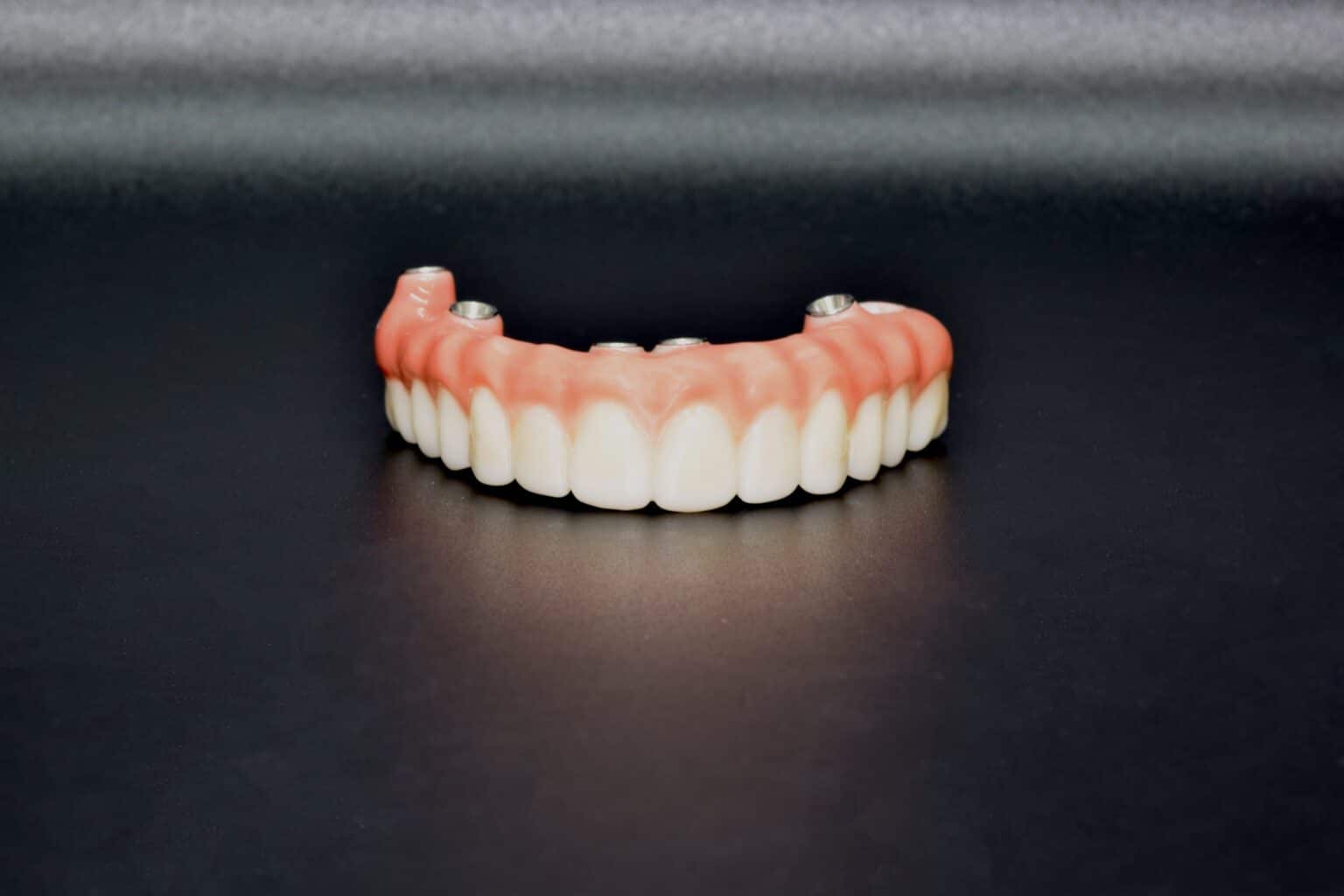 "All on 4" Full Zirconia Arch - Procedure - Utica Dental Laboratory