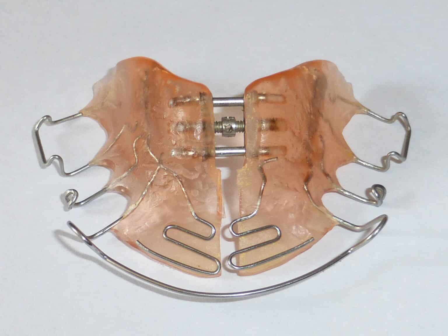 NIGHT GUARDS AND RETAINERS - Utica Dental Laboratory