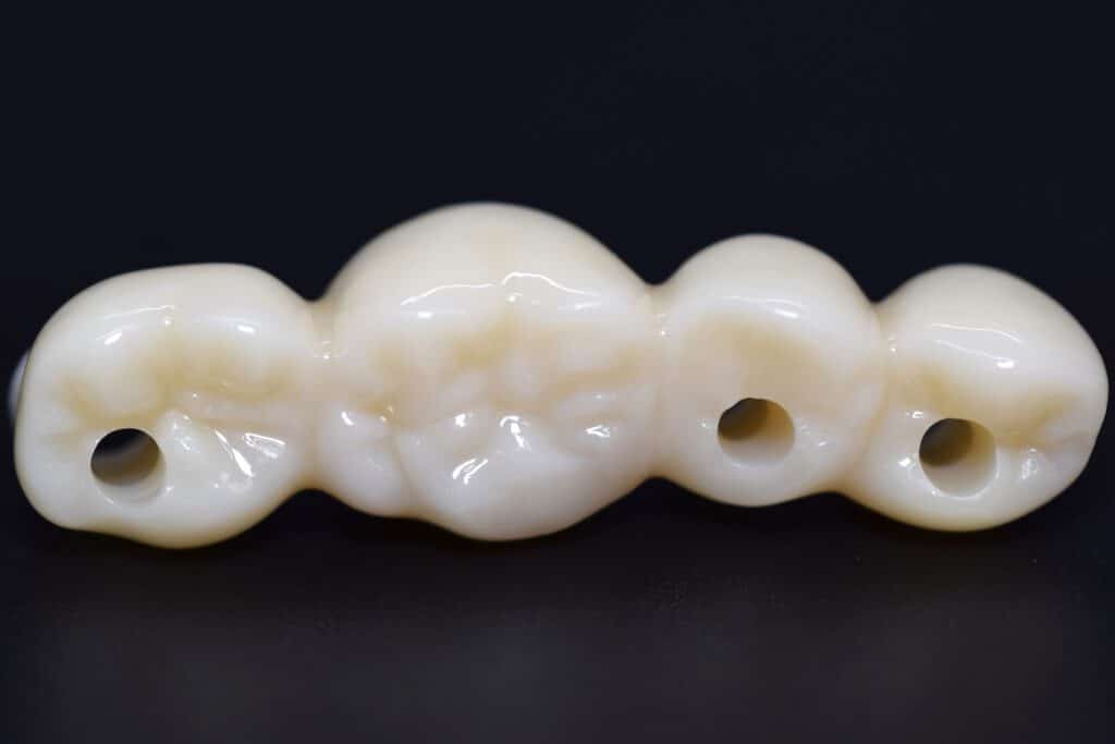 MILLED FULL METAL CROWNS - Utica Dental Laboratory