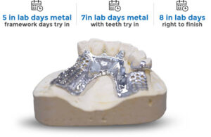 3D Partials - Utica Dental Laboratory
